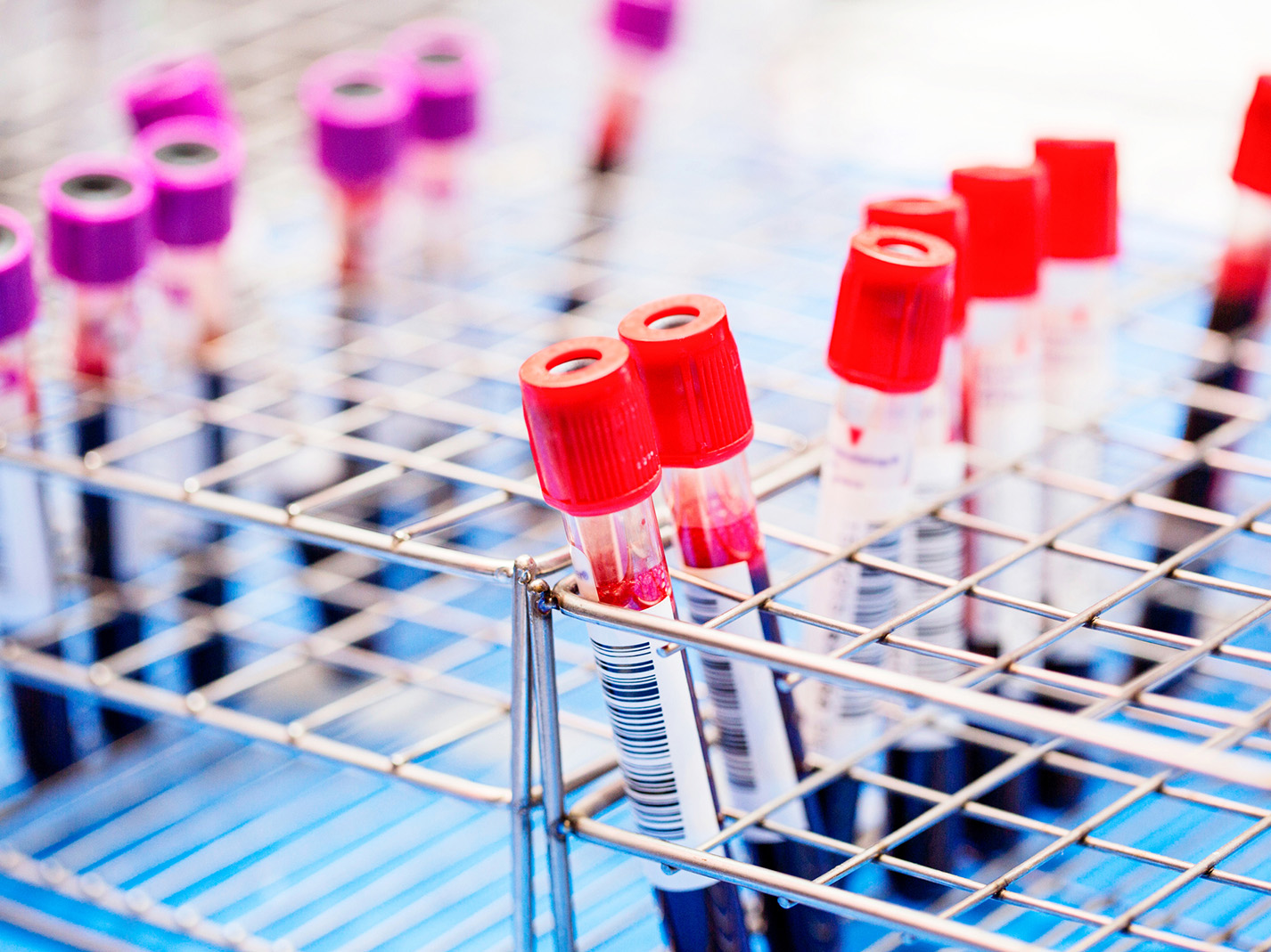 Hematology & Cellular Therapy – Los Angeles, CA | Cedars-Sinai
